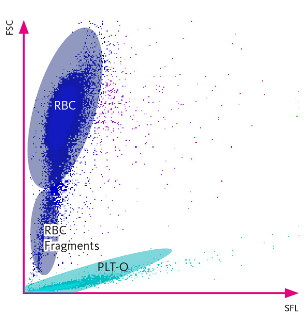 New CBC Parameters in Anemia Diagnostics :: Erba Mannheim